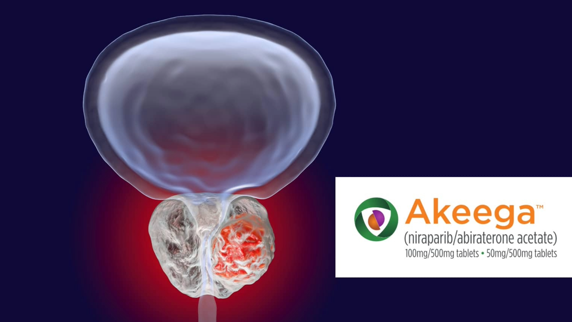 EU Approves AKEEGA for BRCA-Mutated Prostate Cancer | Voice of Healthcare